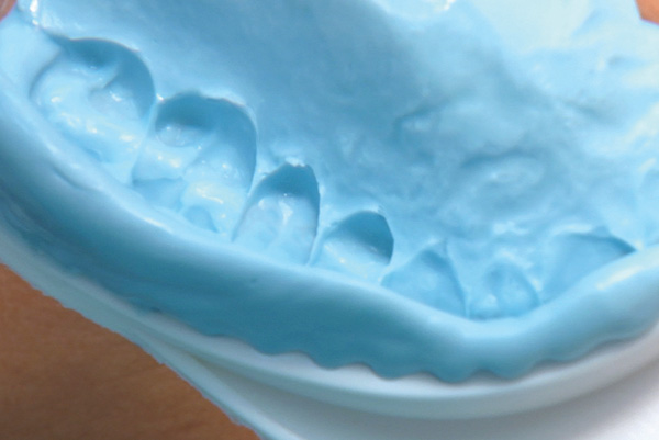 Integrity Multi-Cure Temporary Crown and Bridge Material | May/June ...