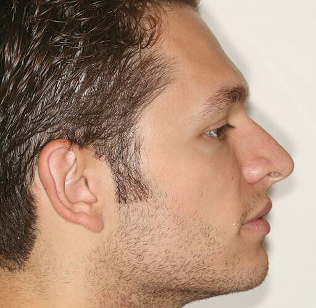Perfect Male Nose Side View