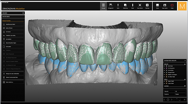 Digital Dentistry Update