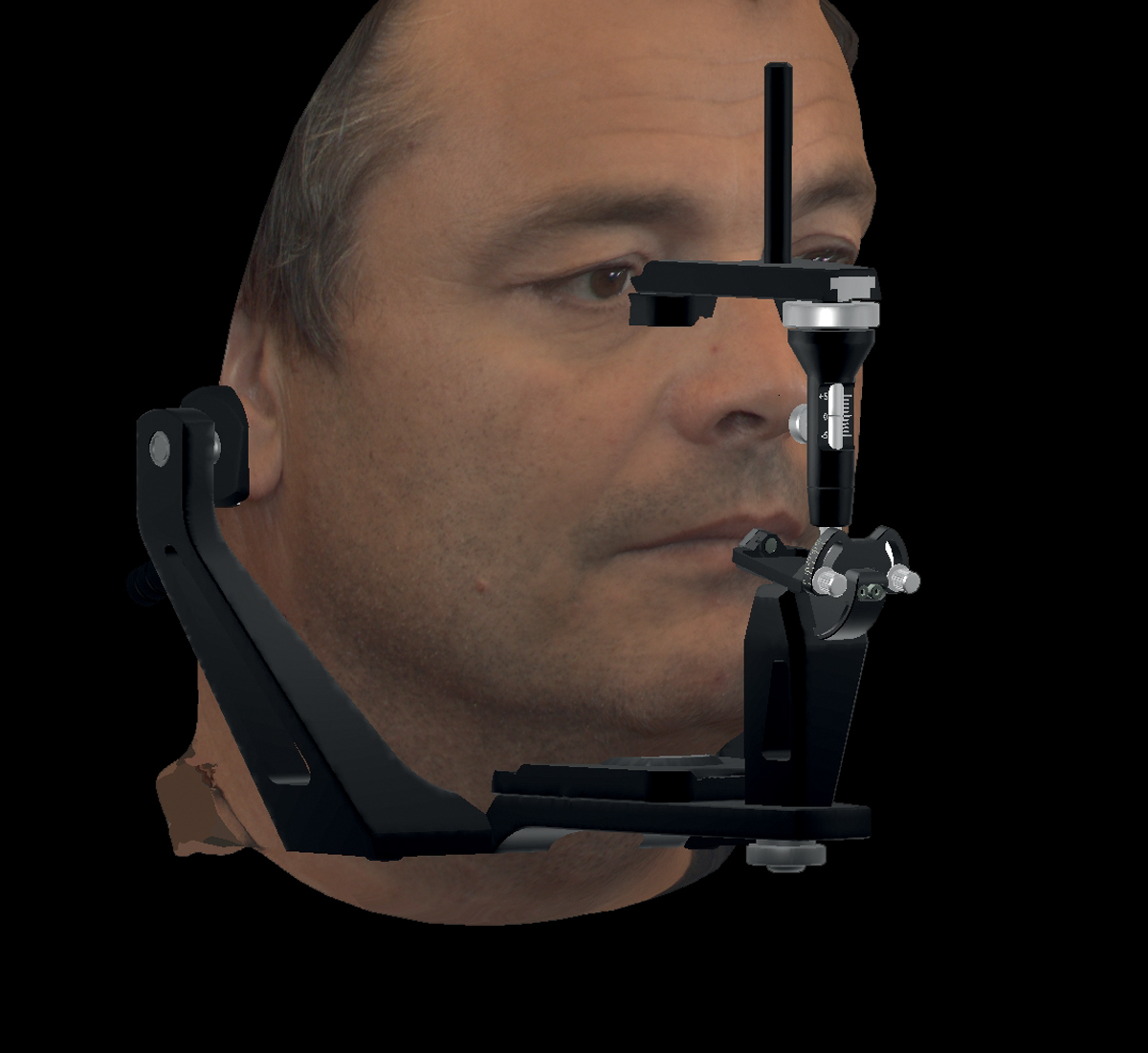 Face Hunter | Inside Dental Technology