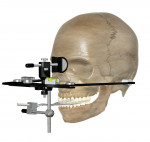 The Use of a Face Bow for Function and Esthetics | Mar/Apr 2012 ...